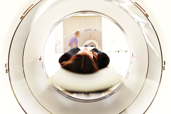 Screening for Breast Cancer Brain Metastases - Metastatic Breast Cancer ...